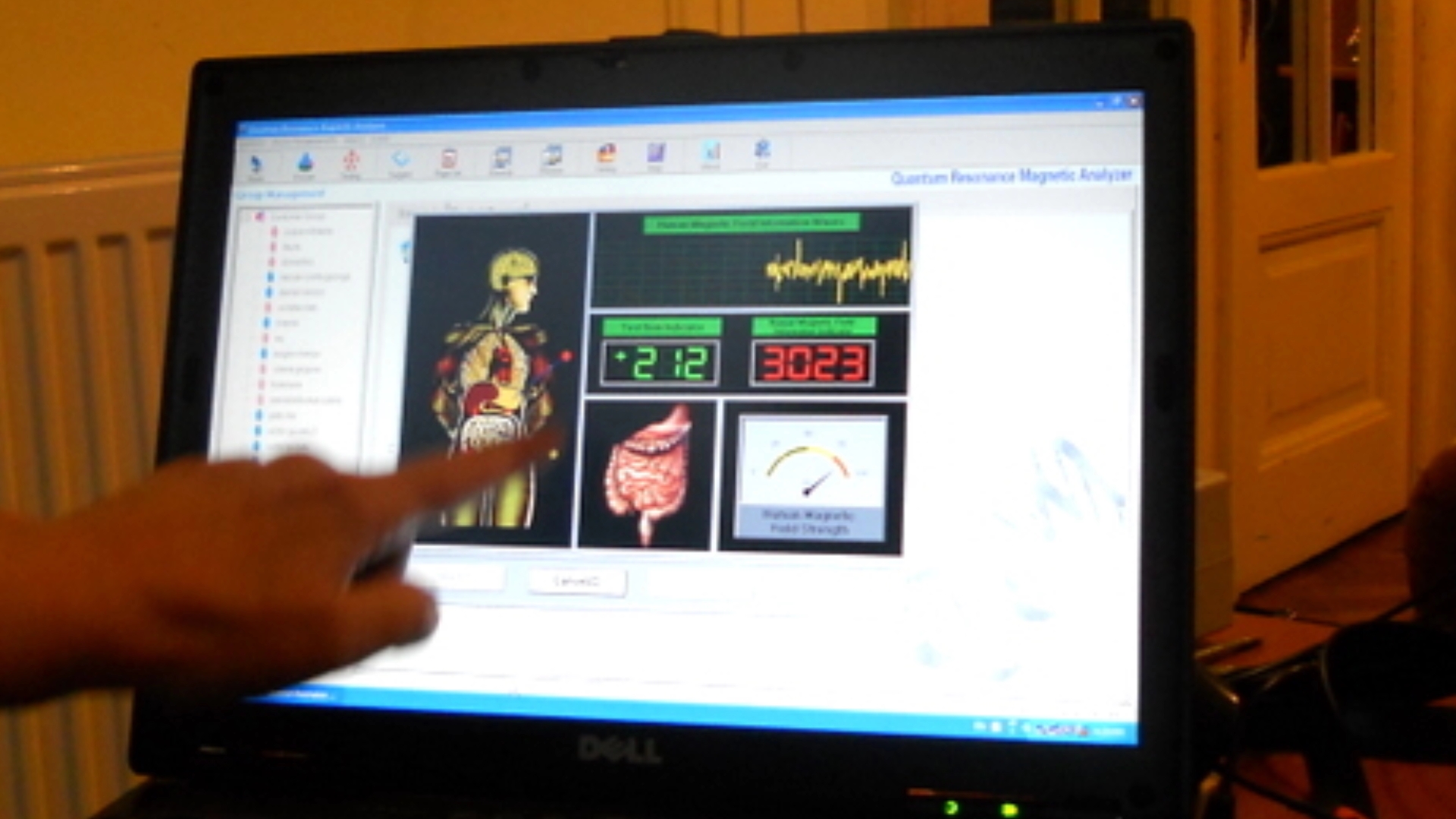 SCIO - cel mai avansat dispozitiv medical de biorezonanta din lume ...