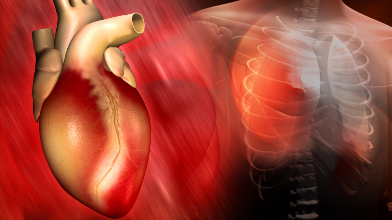 Insuficienta cardiaca - Sensosanatate