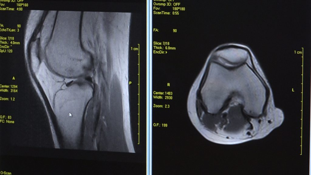Centrokinetic - aparat RMN de ultima generatie pentru afectiuni musculo ...